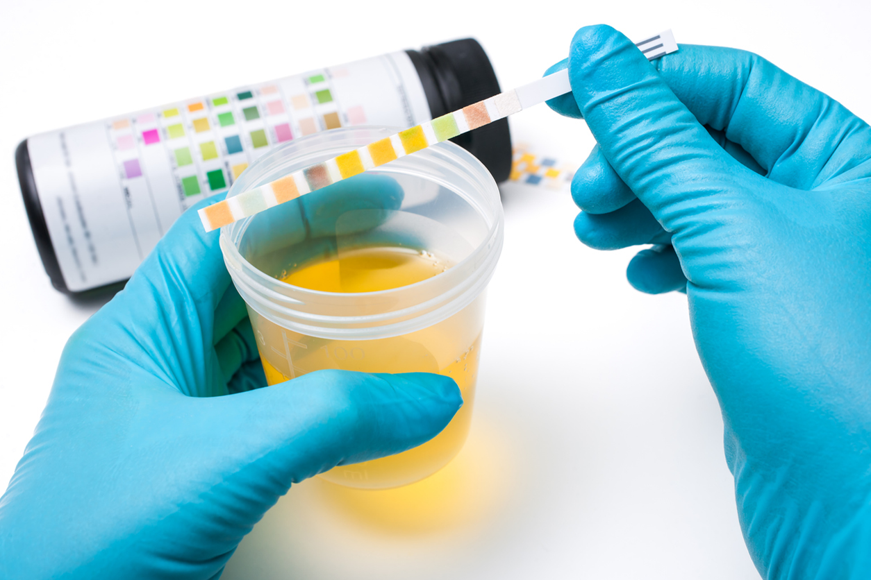 Expediting UTI diagnosis in long-term care using CLIA-waived urine ...