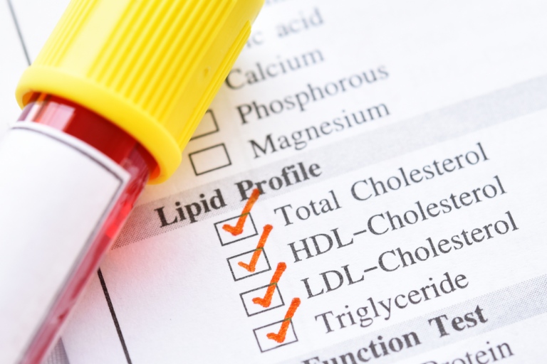 Cholesterol by the numbers: making sense of your lipid profile ...